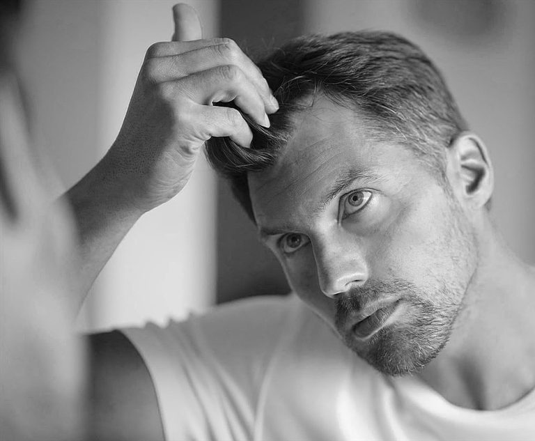 Hair Restore Treatment - EmCyte PRP & ASCE+ Exosomes